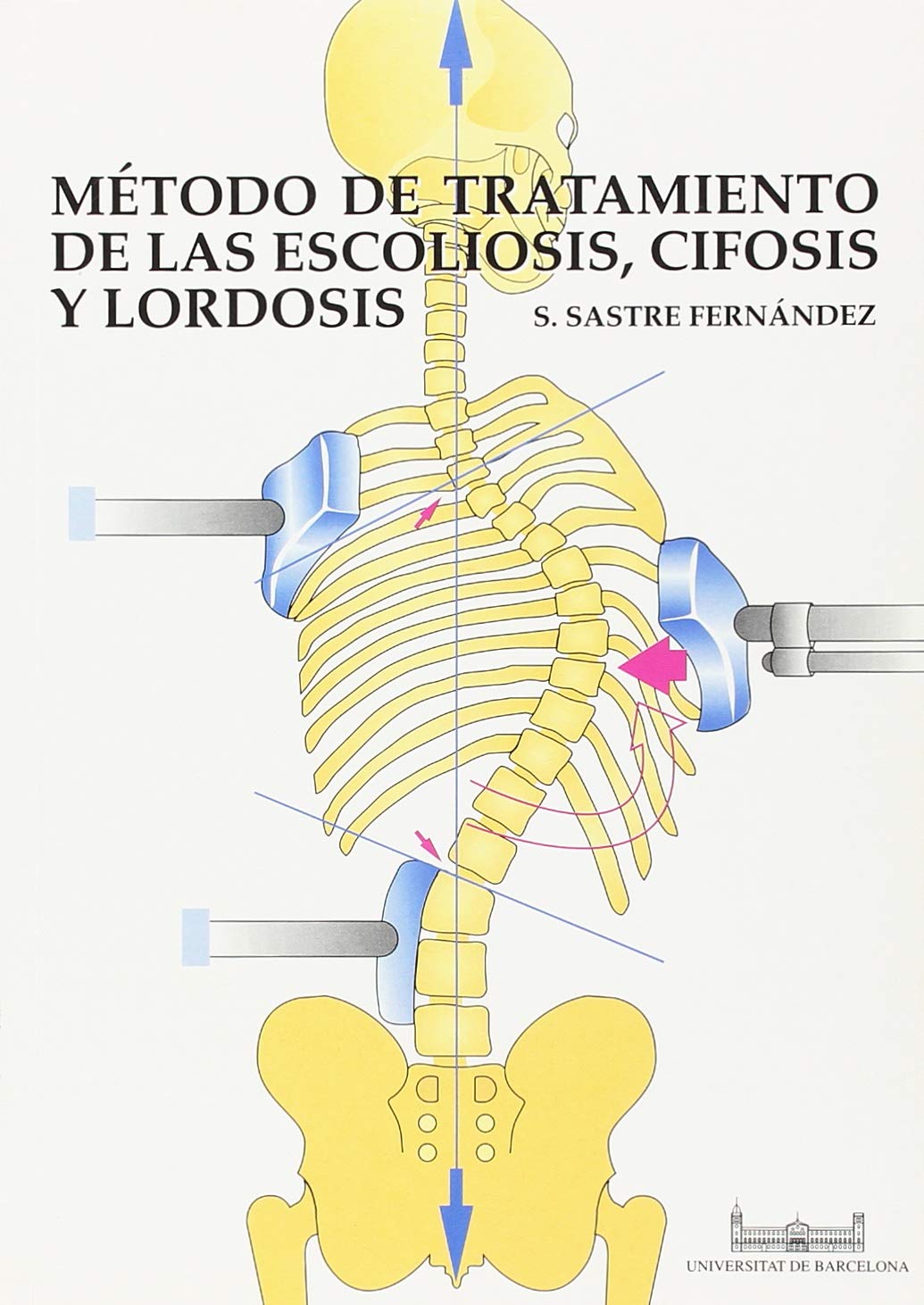 METODO DE TRATAMIENTO DE LAS ESCOLIOSIS, CIFOSIS Y LORDOSIS (SIN ...