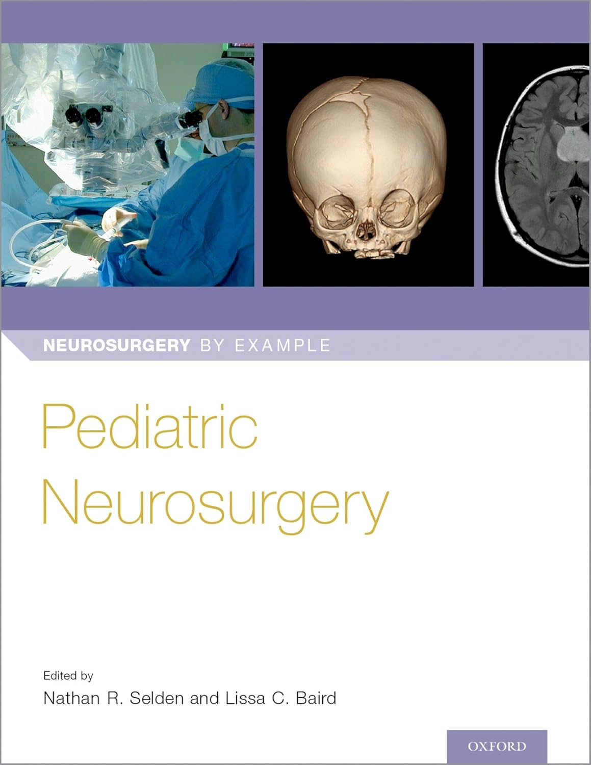 Pediatric Neurosurgery (Neurosurgery by Example) eBook : Selden, Dr ...