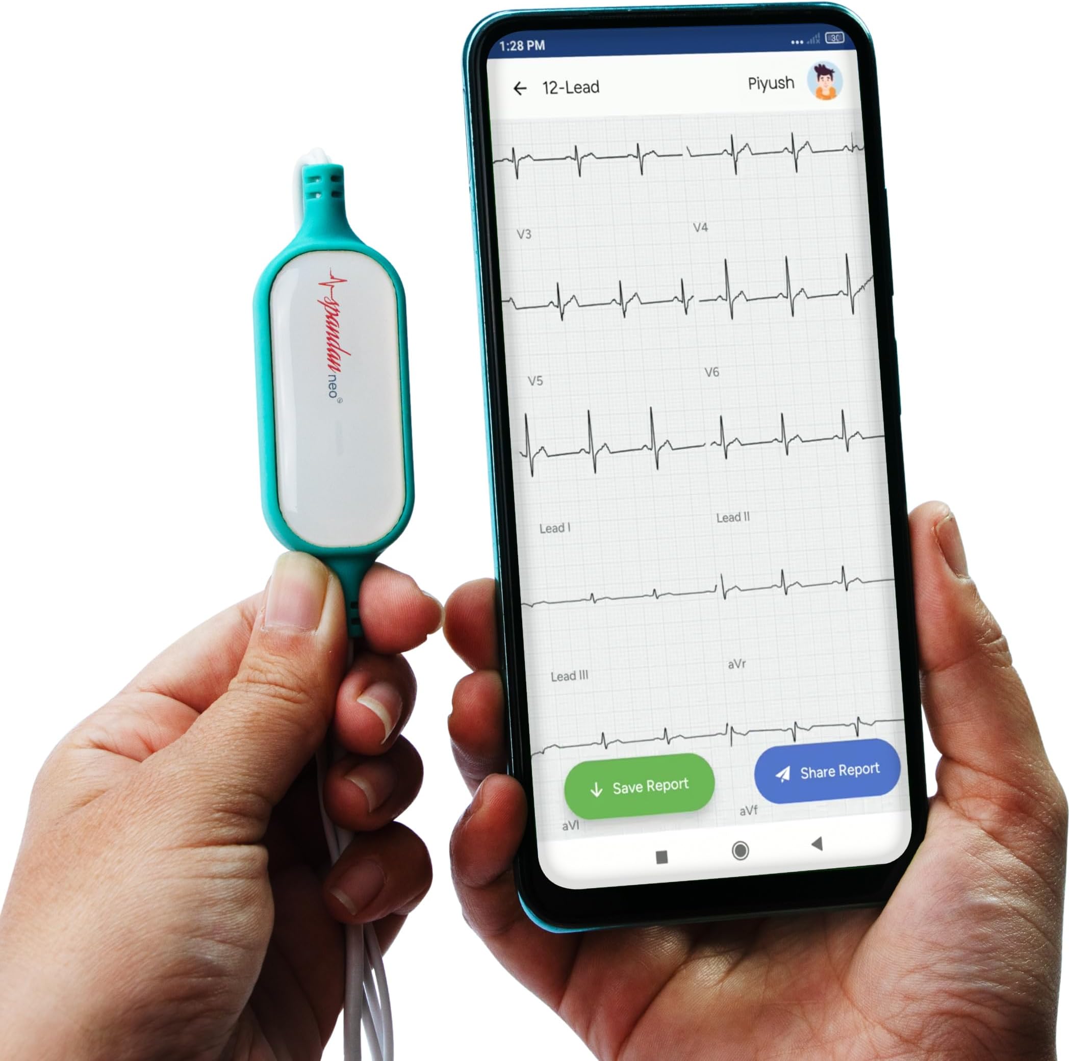 Sunfox Spandan Neo Portable ECG Machine | Home ECG Monitor with 24 Extra Electrodes | Detects ...