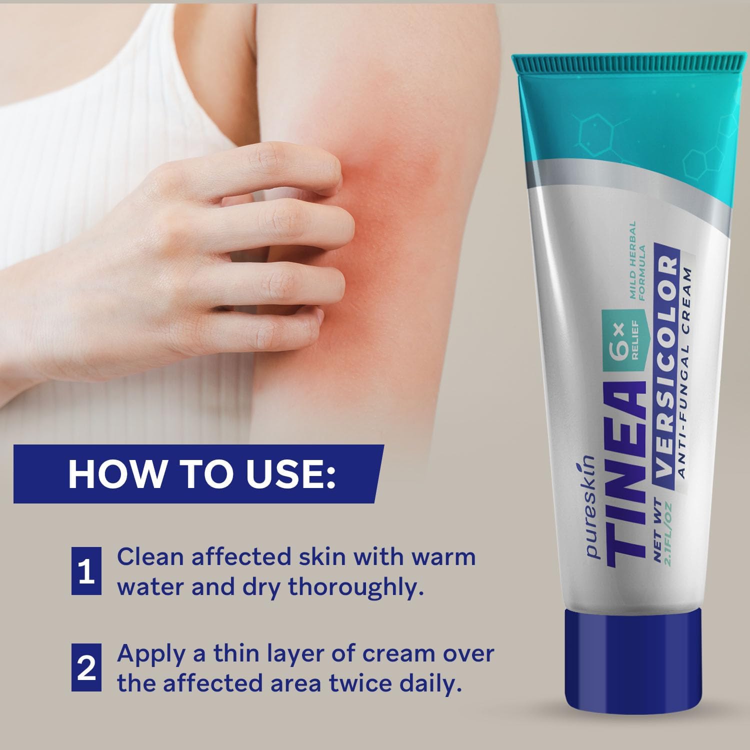 Tinea Versicolor Crema de tratamiento de hongos antifúngico para tiña ...