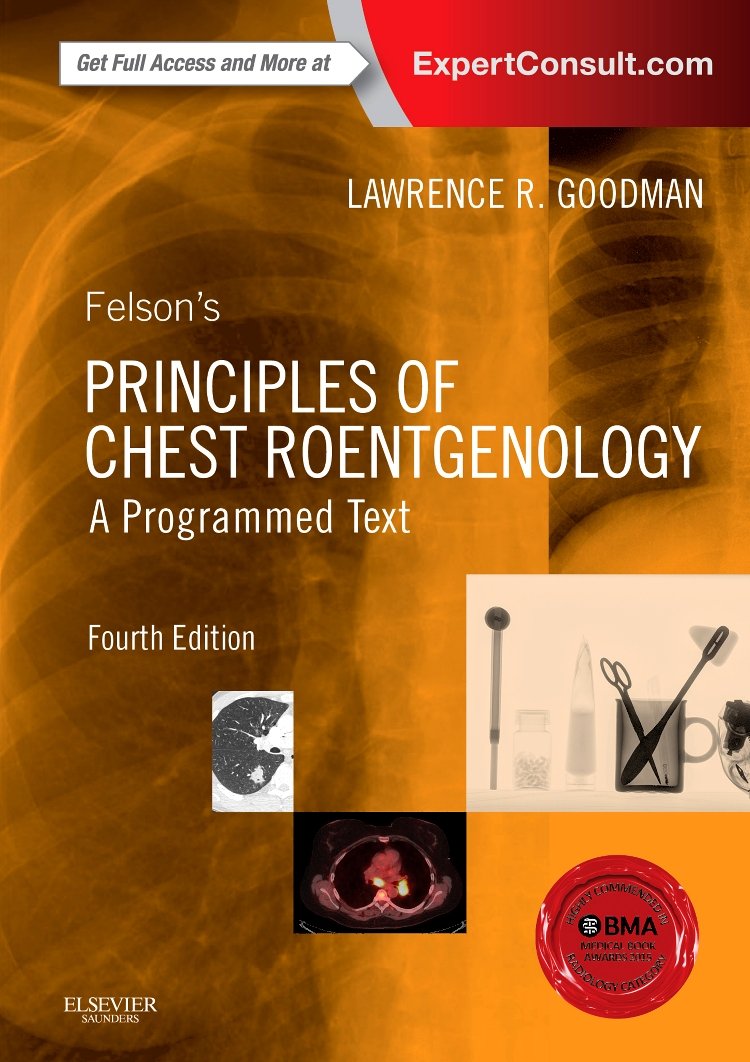 Felson's Principles of Chest Roentgenology, A Programmed Text ...