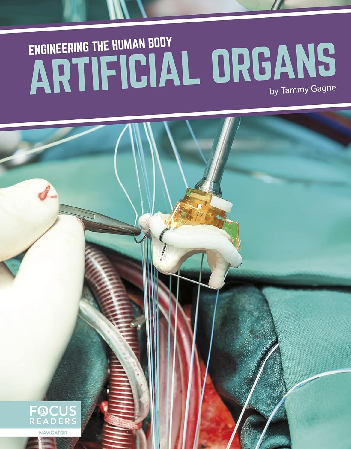 Artificial Organs (Engineering the Human Body (Set of 8)) - Kindle ...