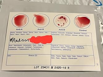Amazon.com: Eldoncard Blood Typing Kit, 2 Test Pack, Know Your Blood ...