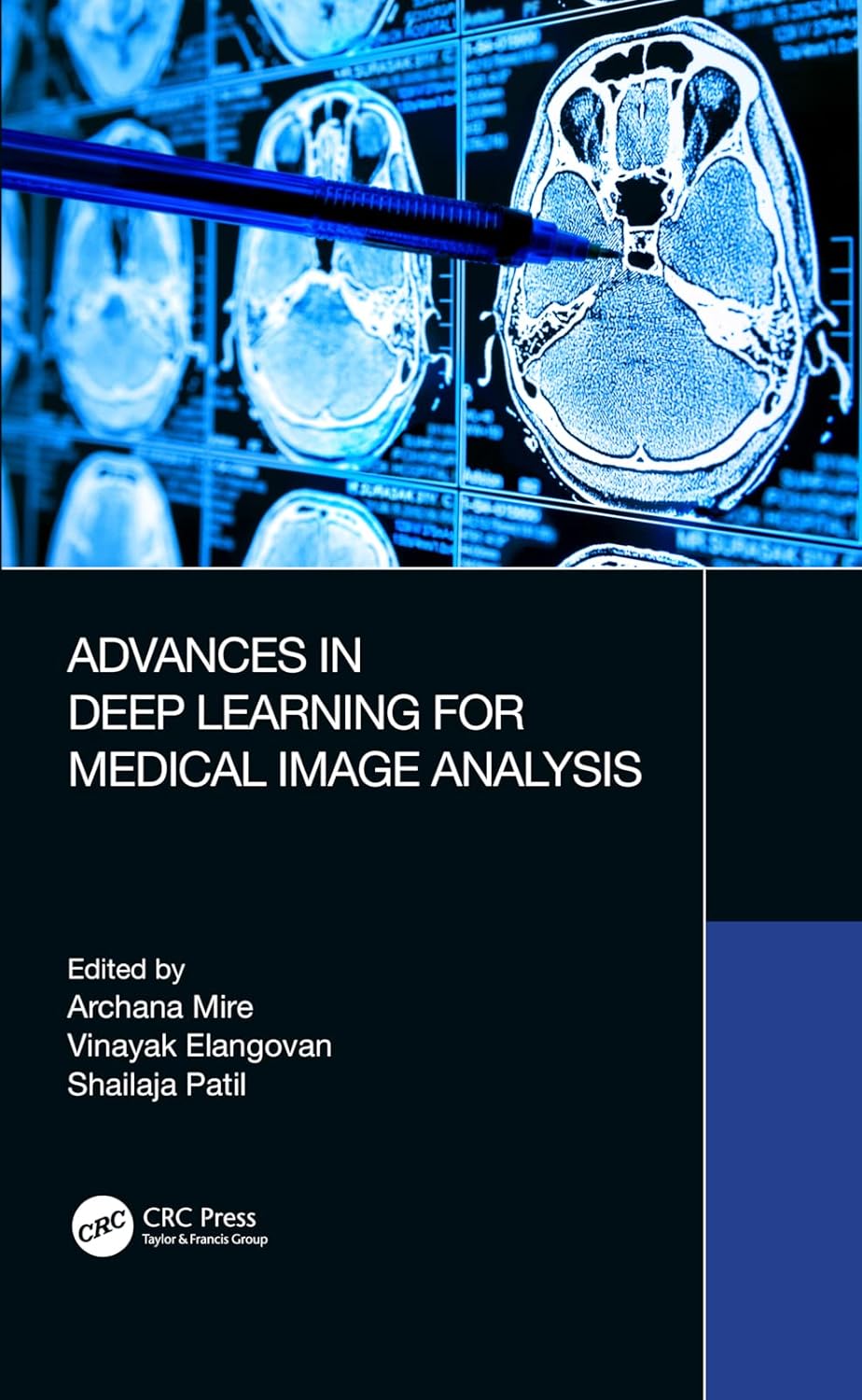 Advances in Deep Learning for Medical Image Analysis: 9781032137162 ...