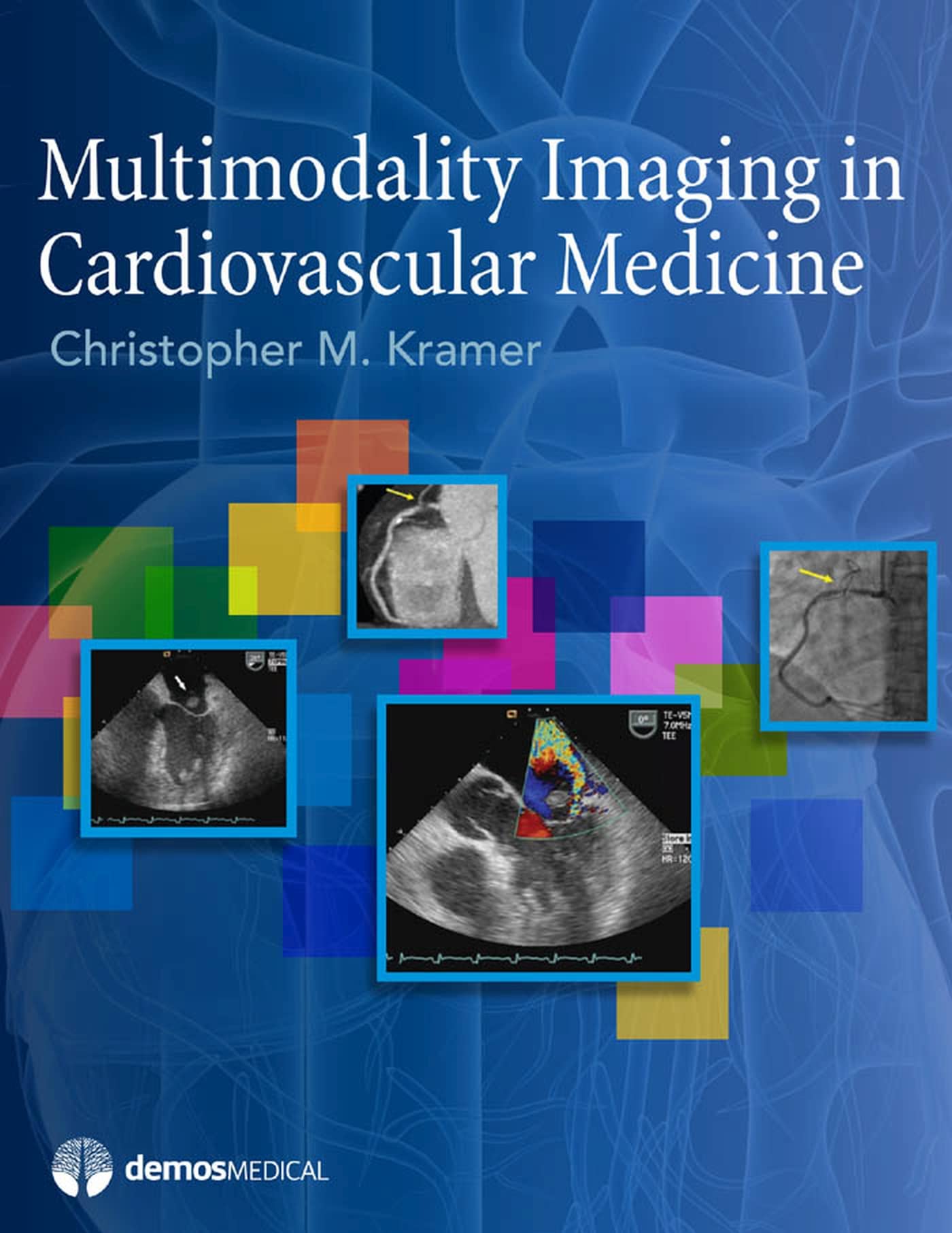 Multimodality Imaging in Cardiovascular Medicine: 9781933864747 ...
