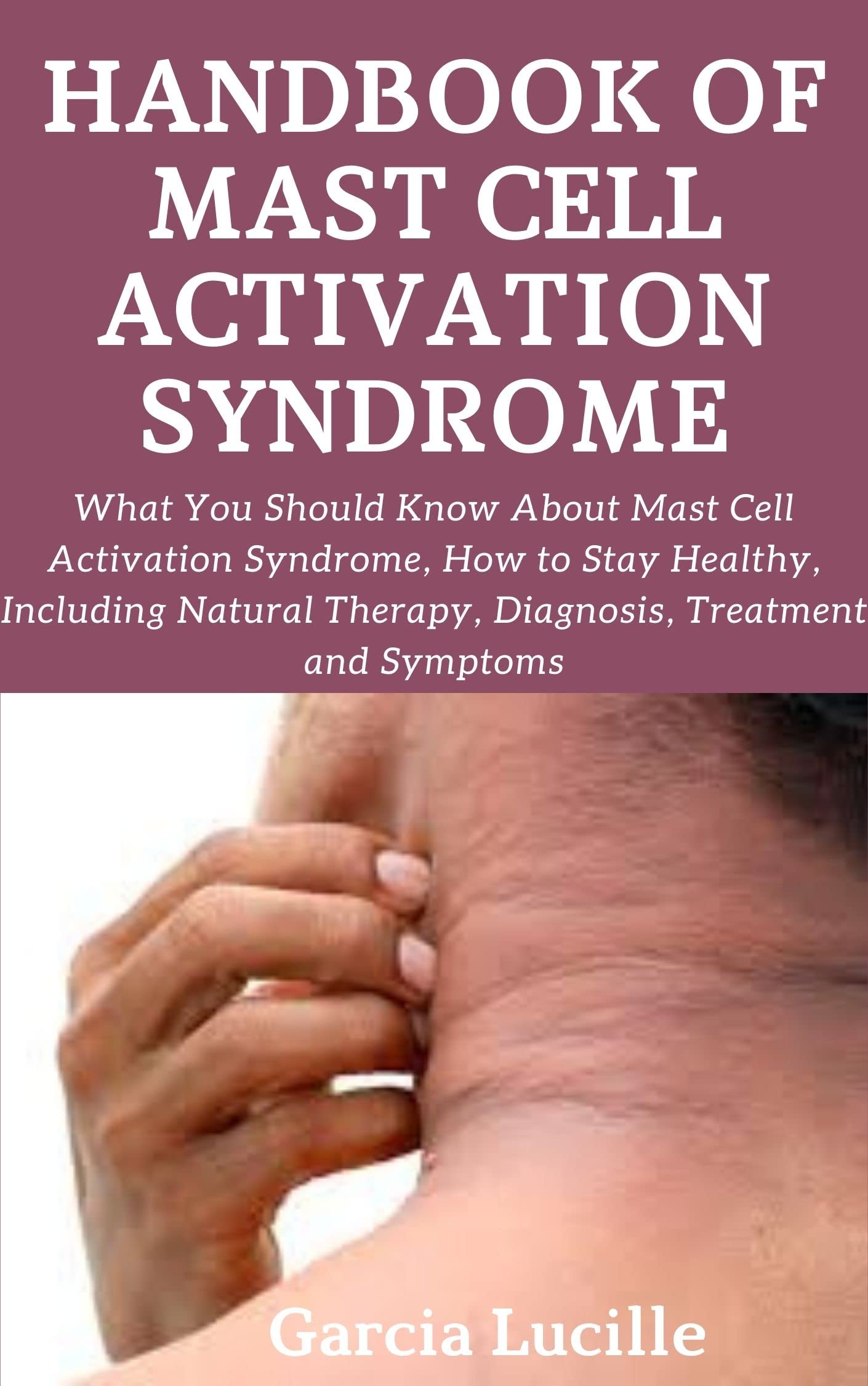 Buy HANDBOOK OF MAST CELL ACTIVATION SYNDROME: What You Should Know ...