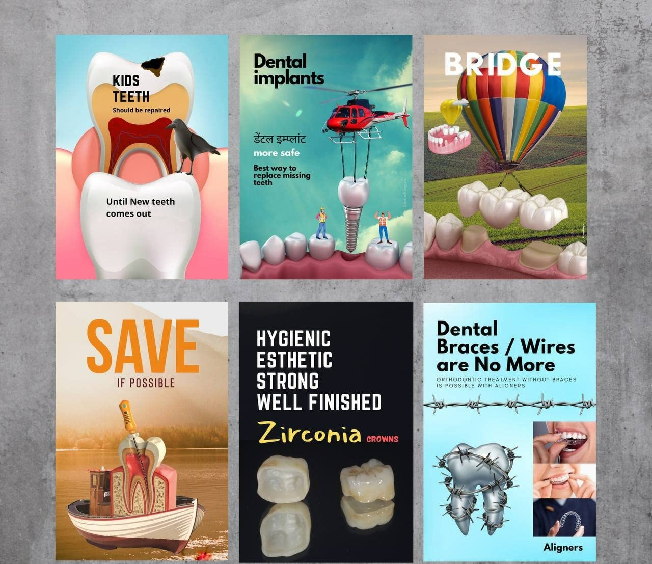 Package of 6 Posters Dental patient education posters for clinic ...