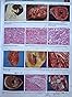 Fundamentals of Pathology - PATHOMA 2018 : HUSAIN A. SATTAR: Amazon.co ...