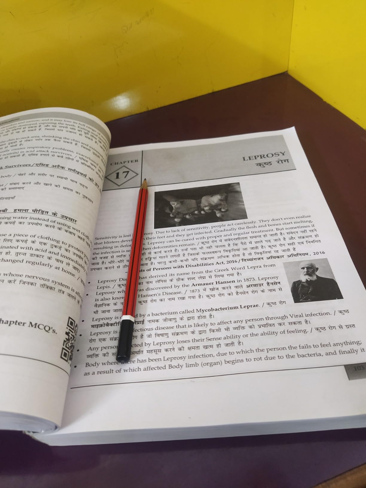 Special Education Bilingual Book For Prt & Tgt Exam : Rohit Vaidwan ...