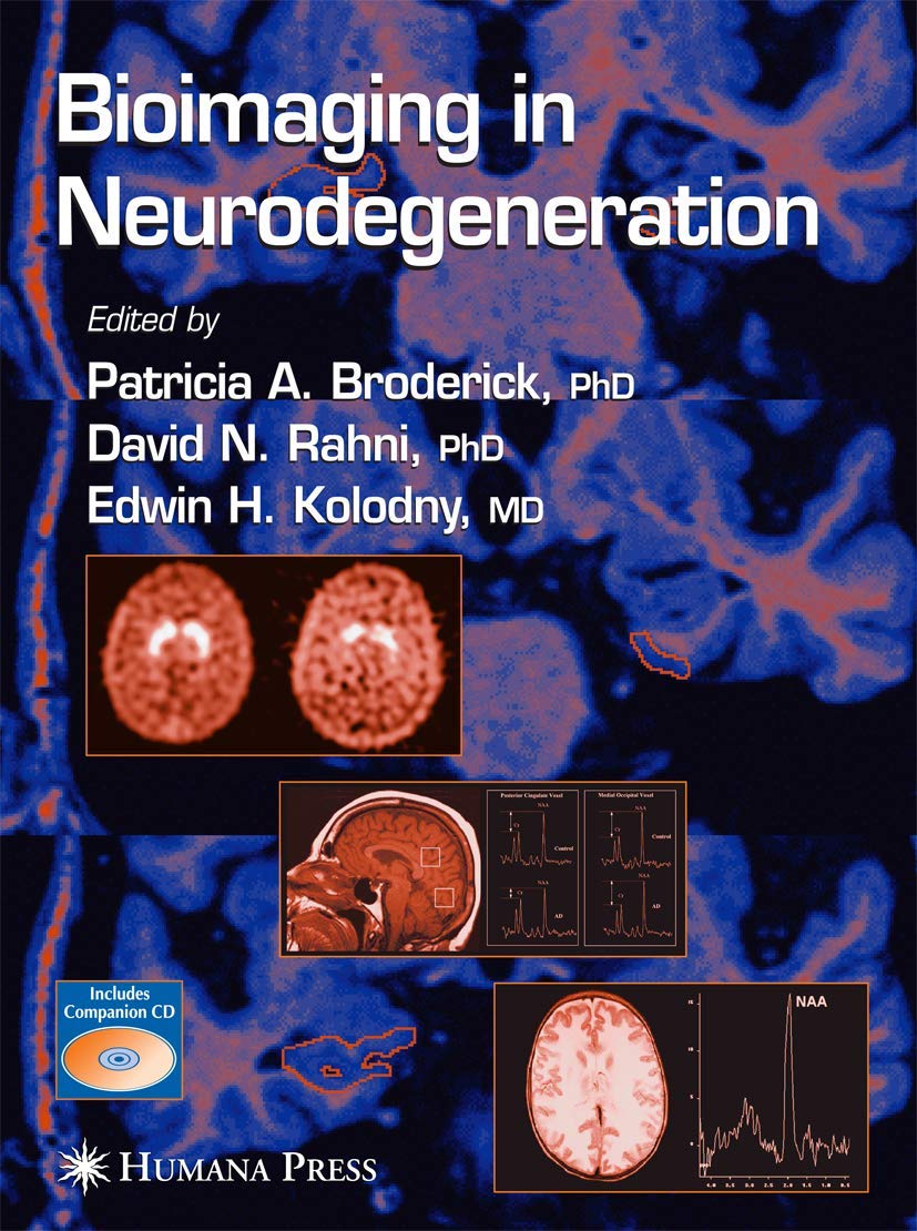 Bioimaging in Neurodegeneration (Contemporary Neuroscience ...