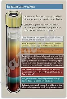 Chills, Fatigue, And Rusty Urine: What Your Body Is Telling You | MedShun