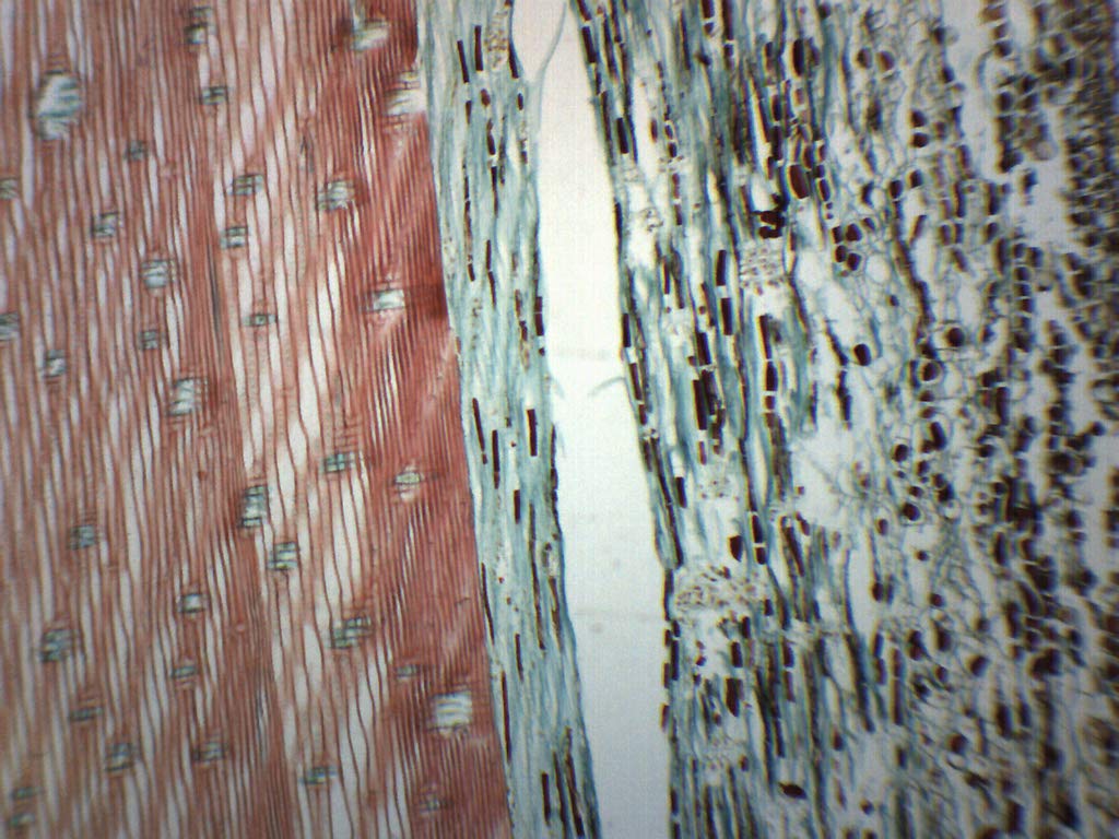 Xylem Cell Under Microscope