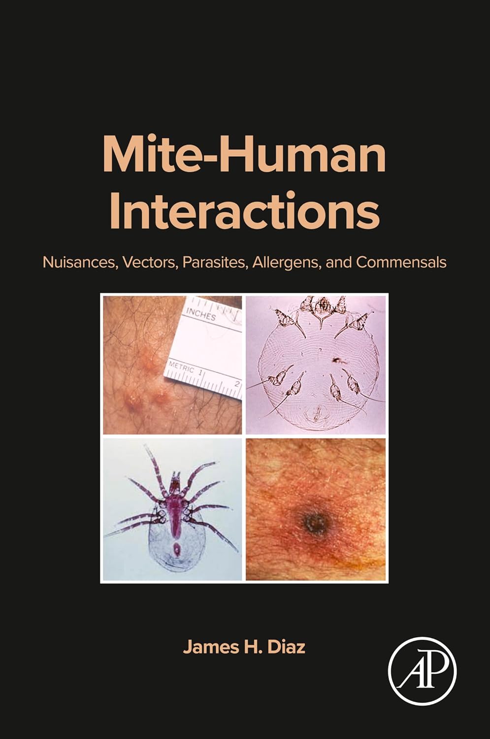 Amazon.com: Mite-Human Interactions: Nuisances, Vectors, Parasites ...