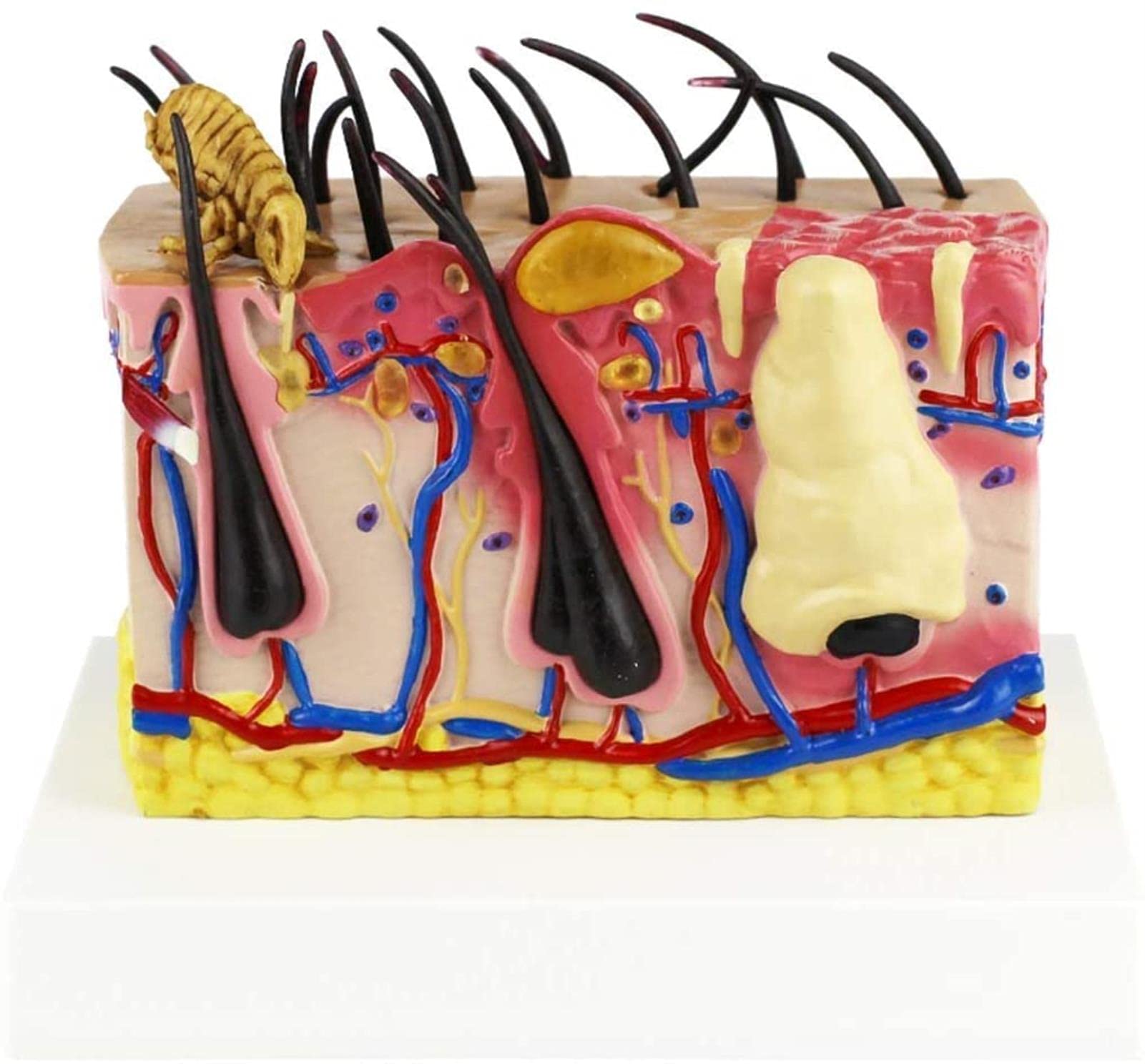 Buy Educational Model Mites Bites Human Skin Anatomical Model Skin ...