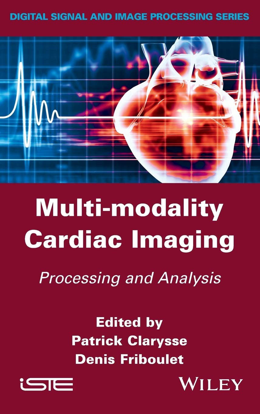 Multi-modality Cardiac Imaging: Processing and Analysis (Digital Signal ...