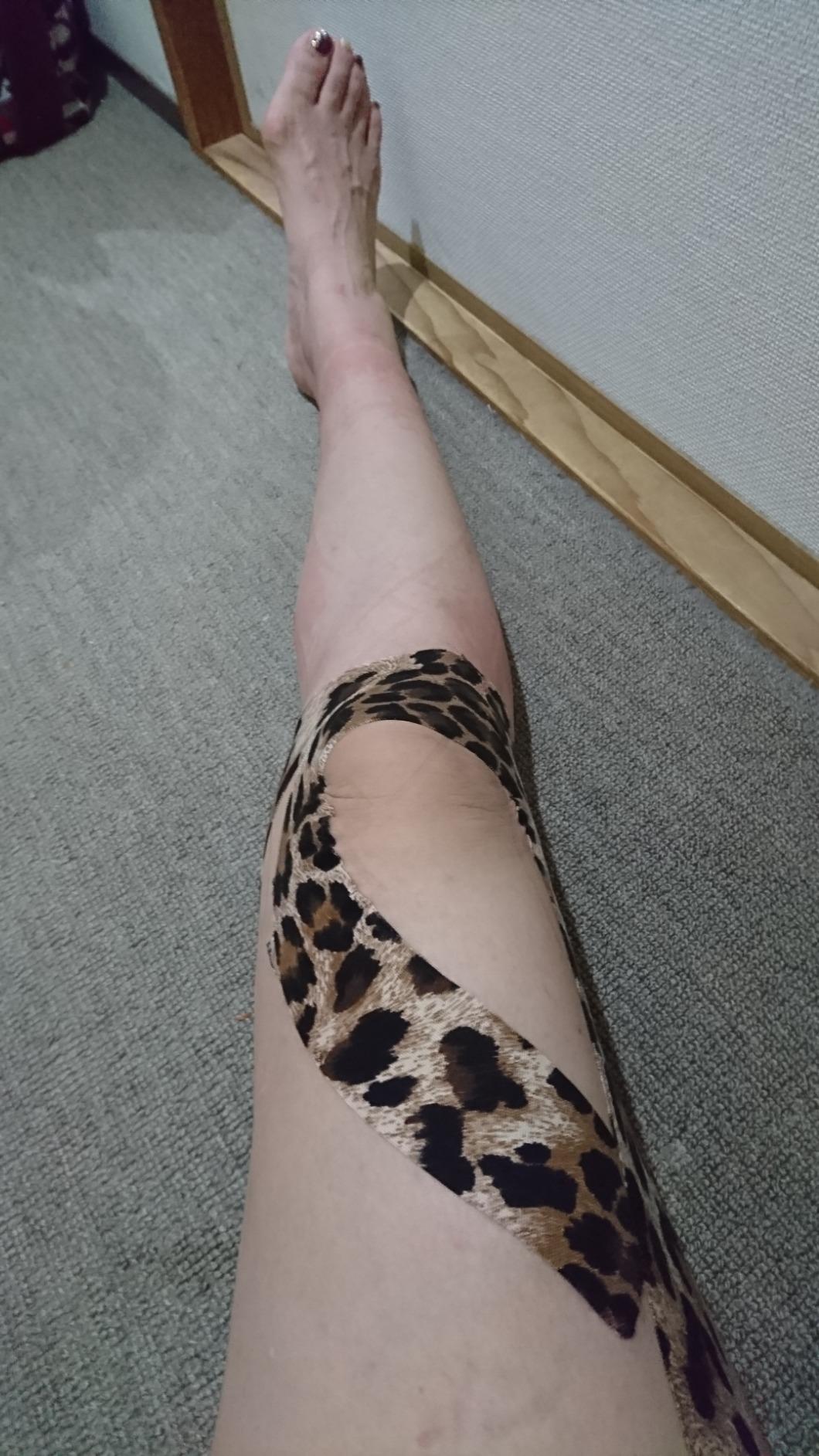 Amazon | ジーオーエヌ GONTEX 膝貼足2＋ | GONTEX | テーピング用品