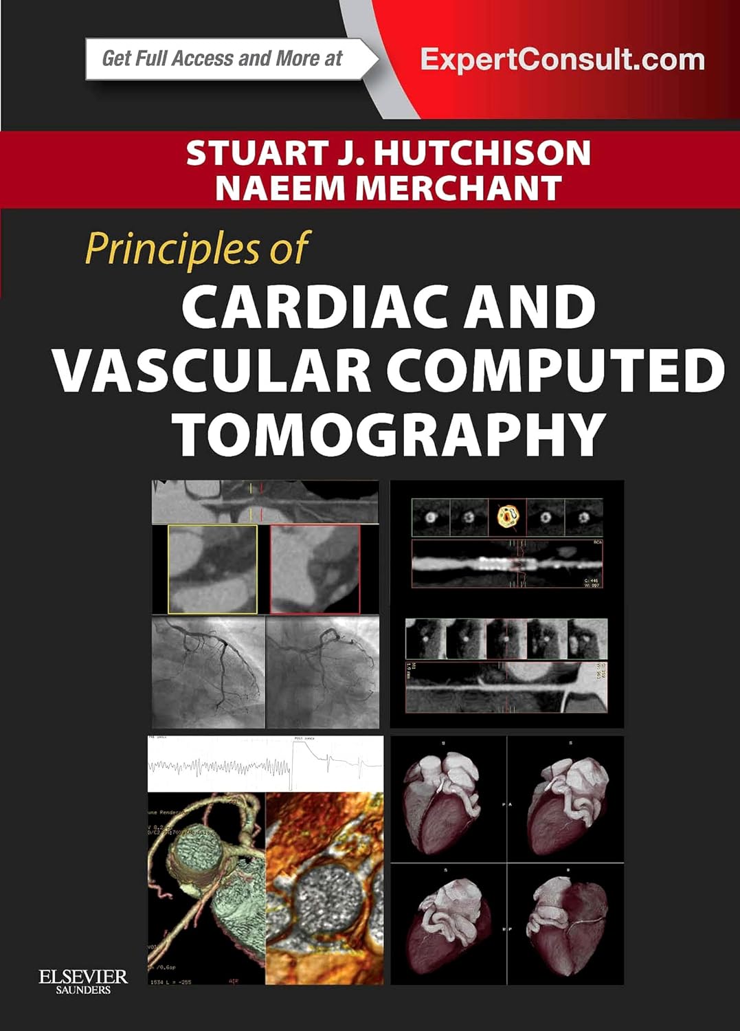 Principles of Cardiac and Vascular Computed Tomography (Principles of ...