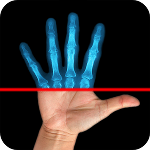 X-Ray Scanner - App on the Amazon Appstore