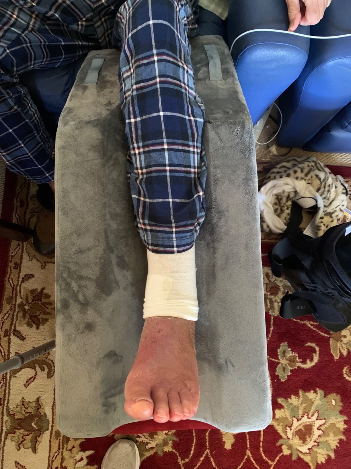 Leg Elevation Wedge Support Pillow with Handles After Surgery, Injury ...