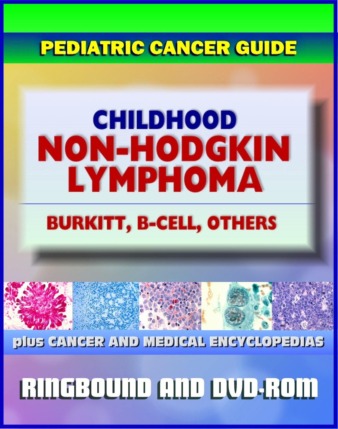 2011 Pediatric Cancer Toolkit: Childhood Non-Hodgkin Lymphoma (NHL ...