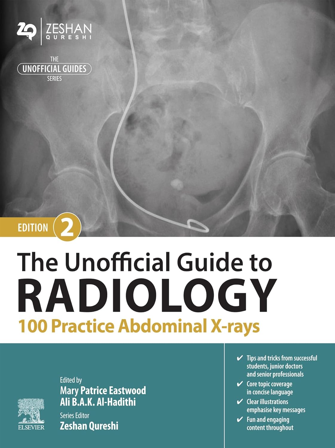 Amazon.com: The Unofficial Guide to Radiology: 100 Practice Abdominal X ...