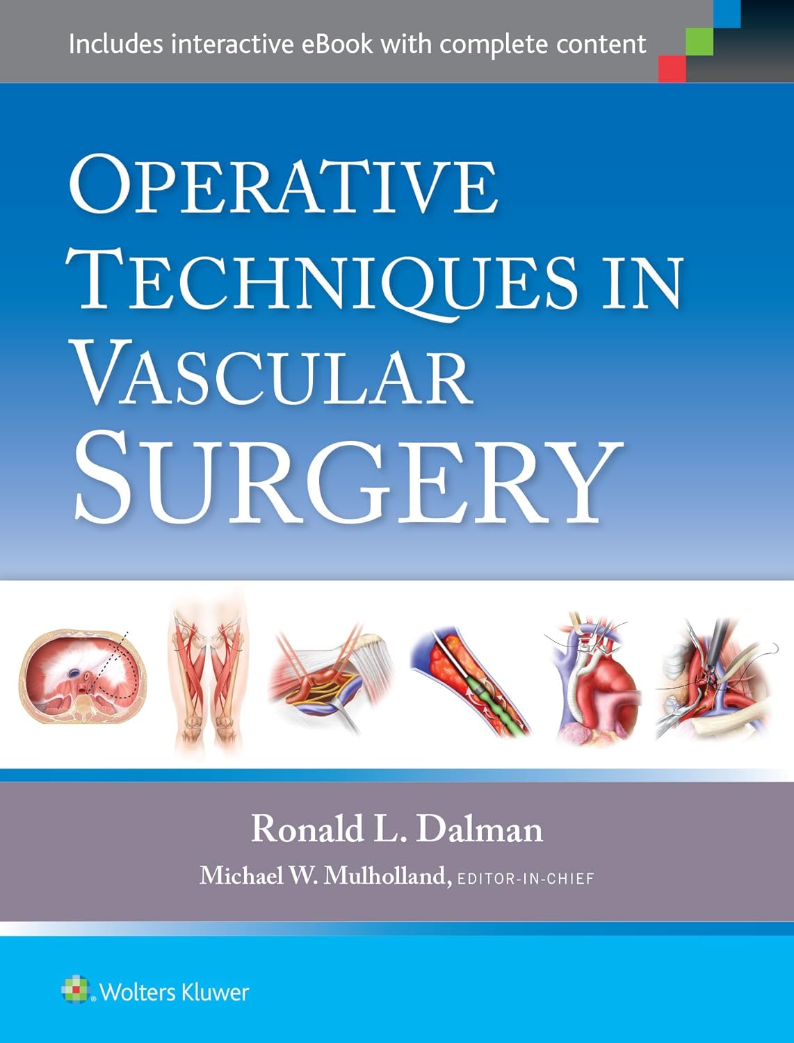 Buy OPERATIVE TECHNIQUES IN VASCULAR SURGERY (HB 2015) Book Online at ...