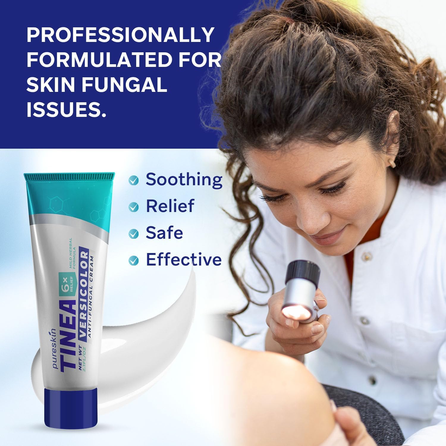 Tinea Versicolor Crema de tratamiento de hongos antifúngico para tiña ...