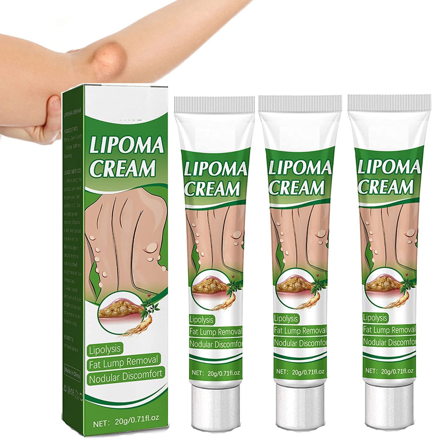 3pcs Lipomacure Soothing Ointment Lumpfree Lipoma Removal Cream Lipoma ...