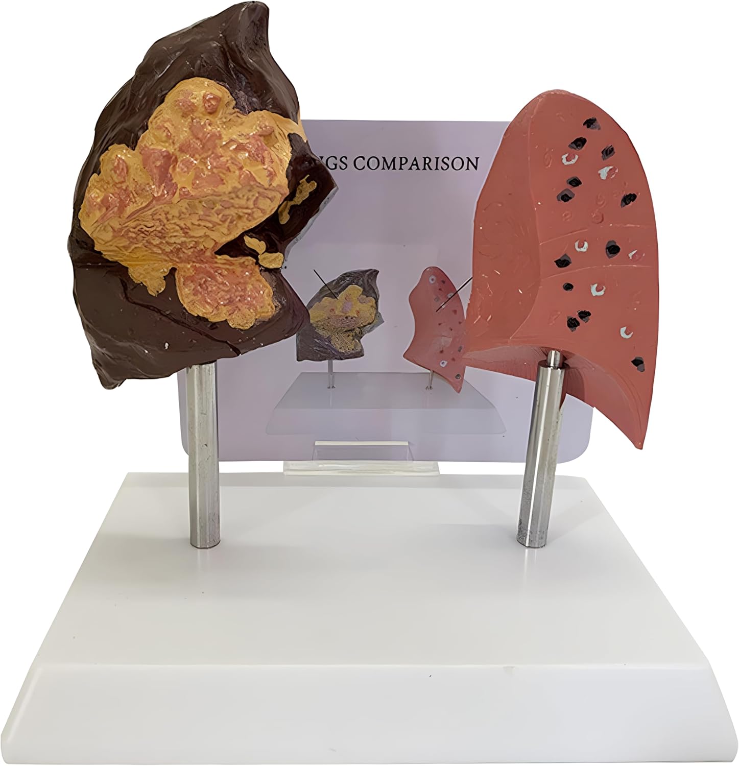 Amazon.com: YANHAO Smokers Lung Versus Regular Lung Model PVC Human ...