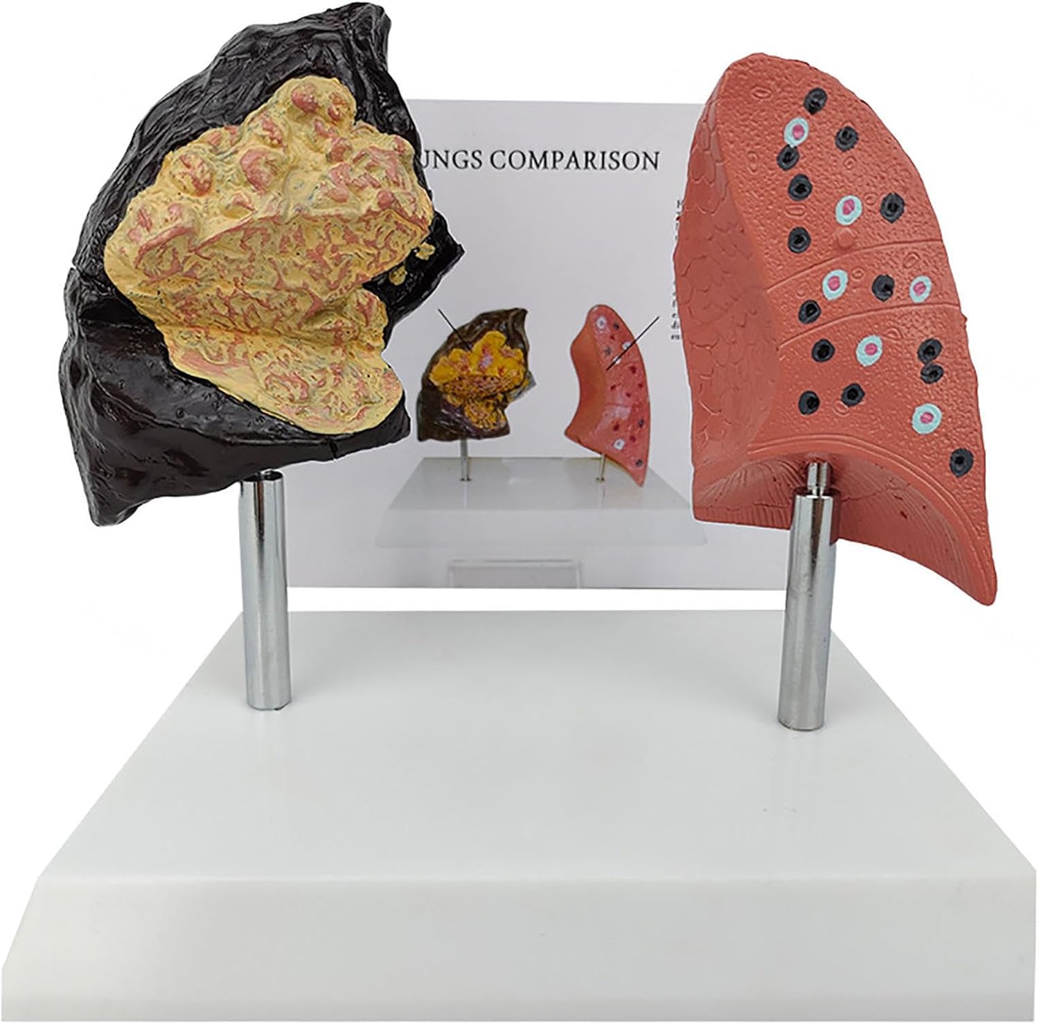 Lung Model + Healthy Lung Model Life Size Human Lung Anatomy Model with ...