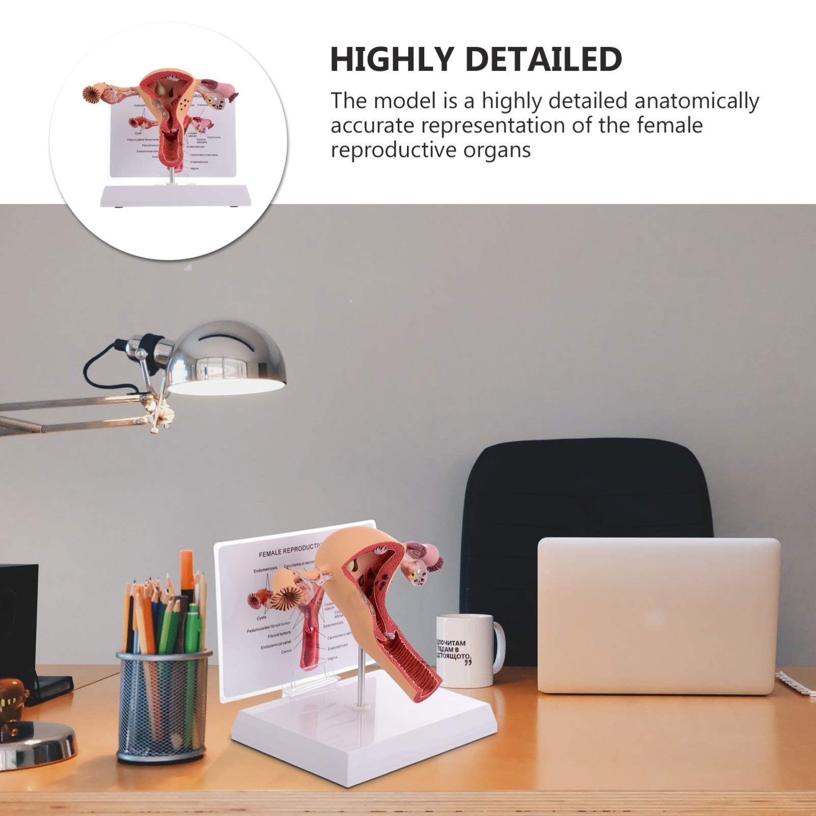 Buy Hemobllo Uterus Ovary Model Female Reproductive Organs System ...