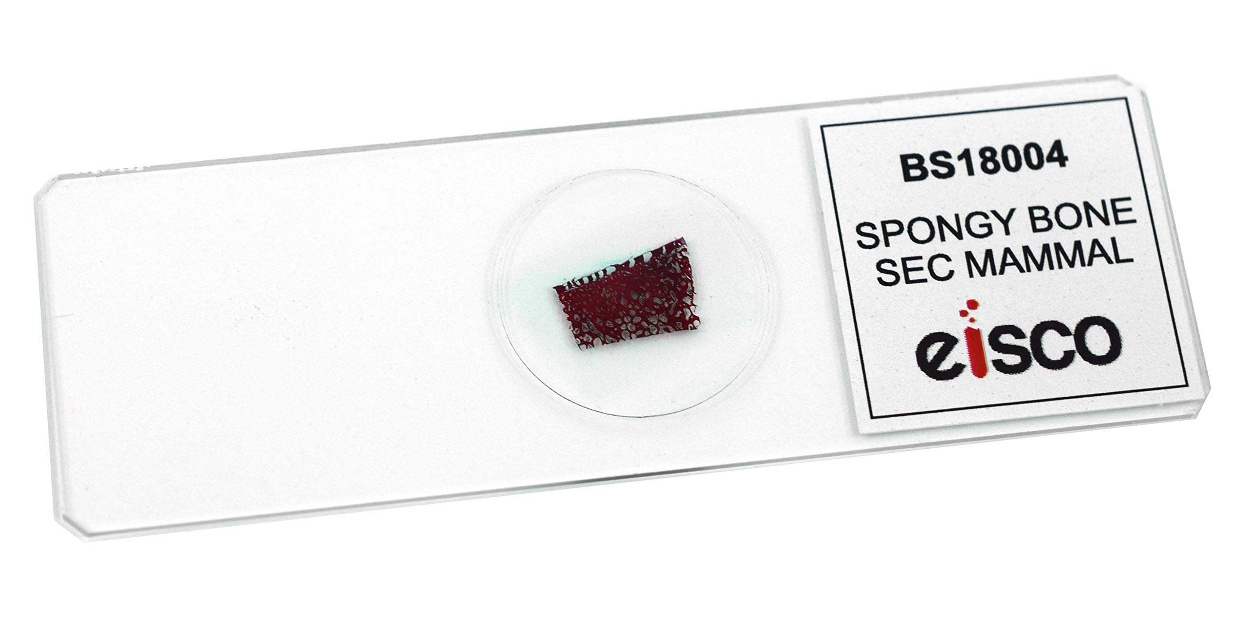 Spongy Bone Under Microscope