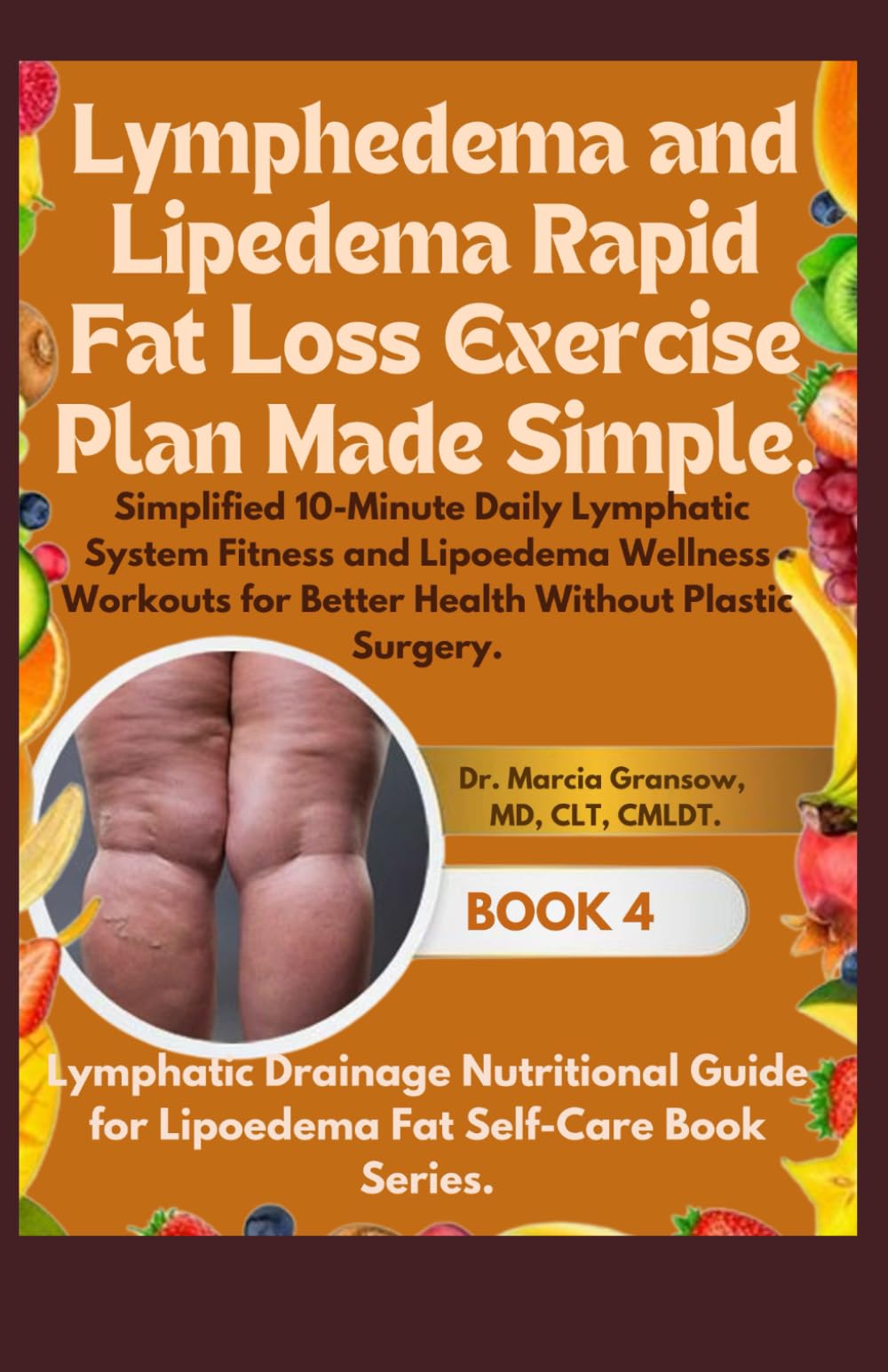 Buy Lymphedema and Lipoedema Rapid Loss Exercise Plan Made Simple ...