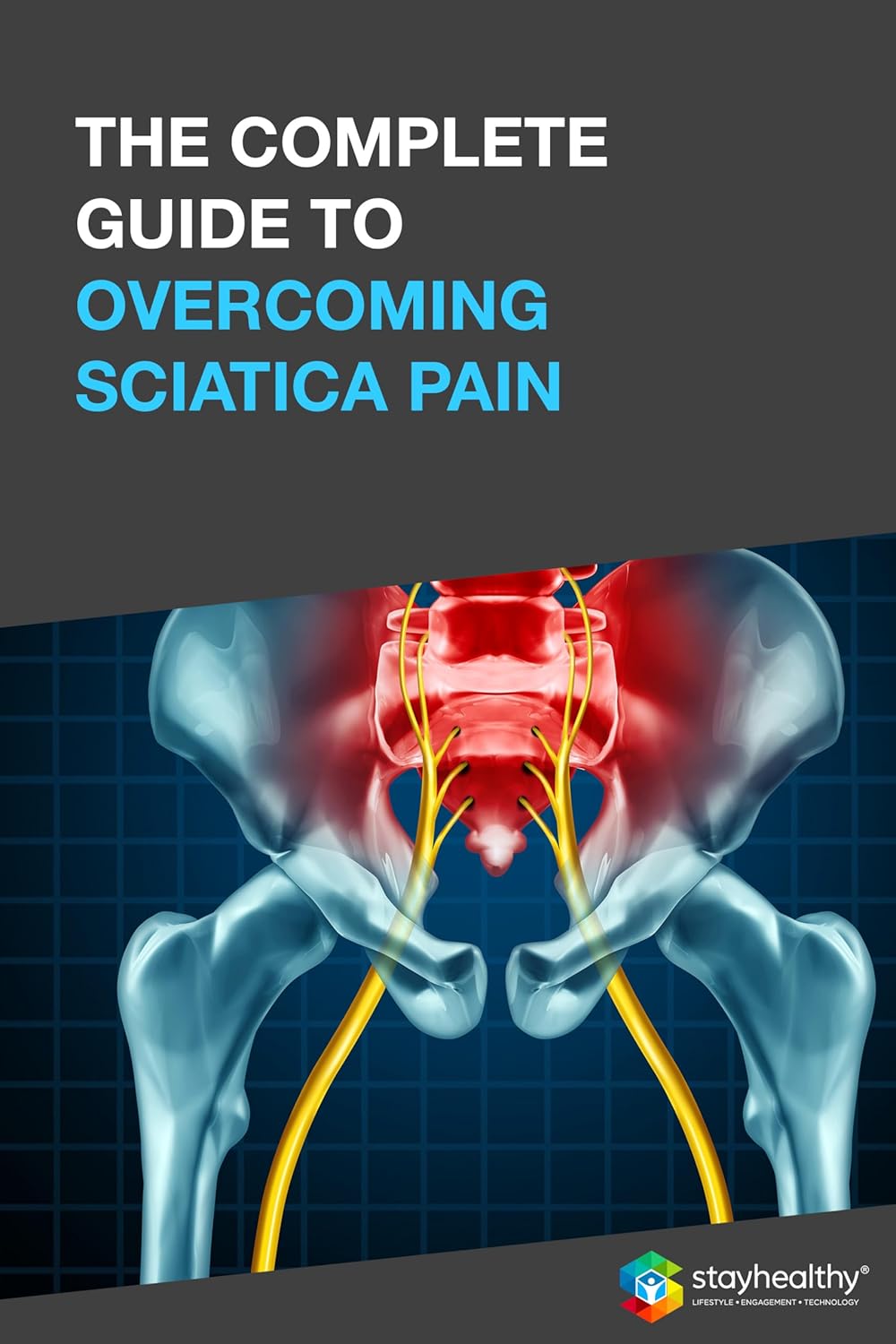 THE COMPLETE GUIDE TO : OVERCOMING SCIATICA PAIN eBook : Stayhealthy : Amazon.co.uk: Books