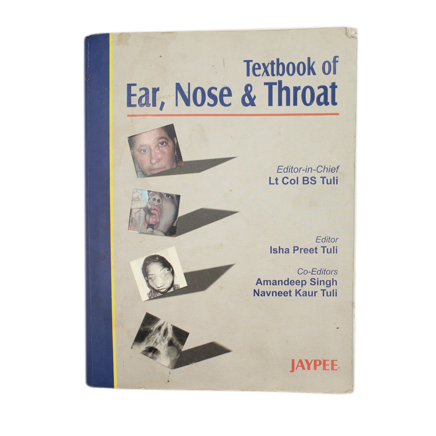 Textbook of Ear, Nose and Throat: Tuli: 9788180614460: Amazon.com: Books