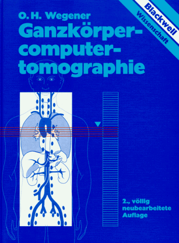 Amazon.co.jp: Ganzkoerpercomputertomographie : Wegener, Otto Henning ...
