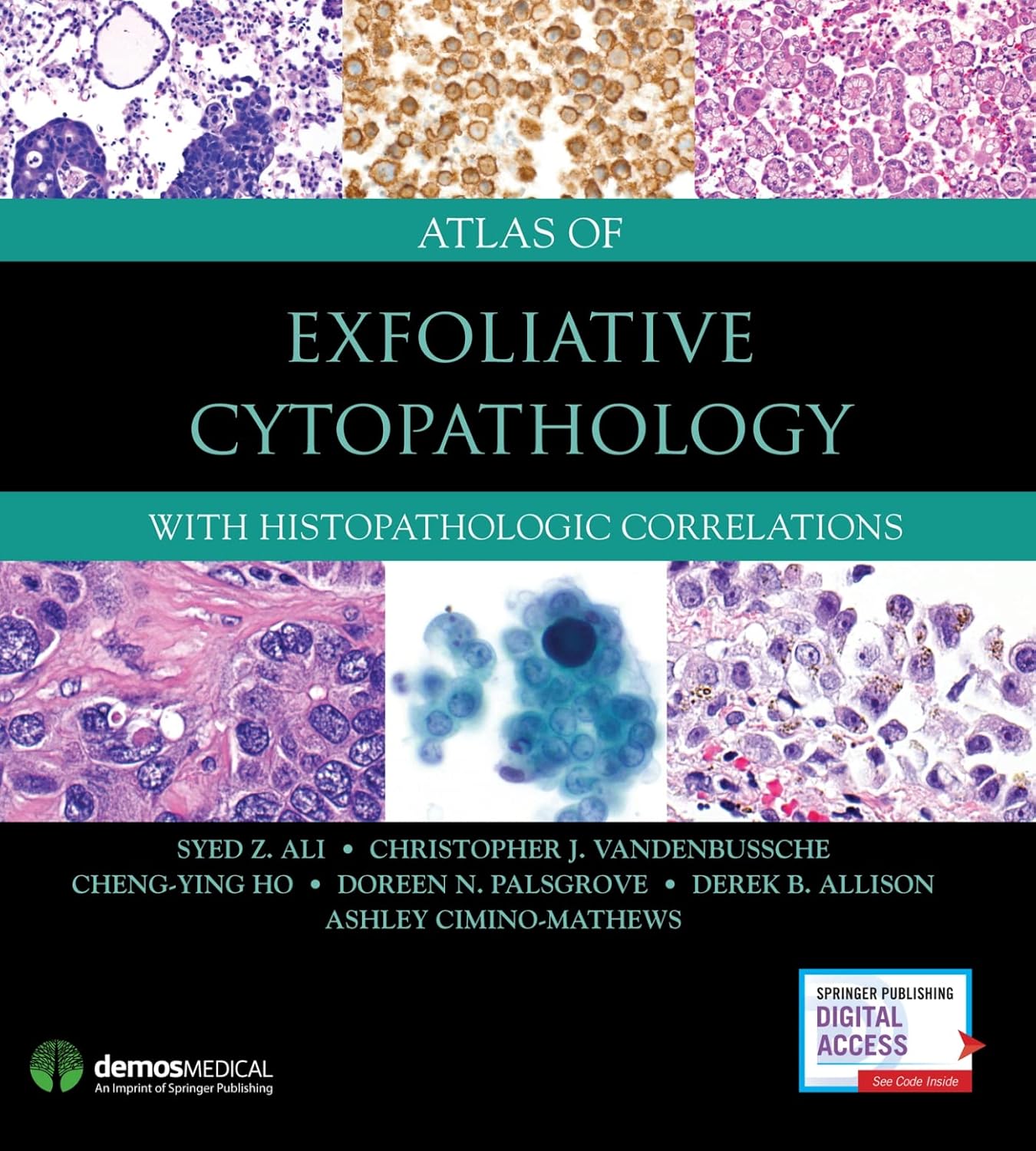 Amazon.com: Atlas of Exfoliative Cytopathology: With Histopathologic ...