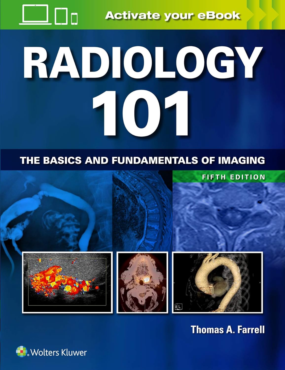 Radiology 101: The Basics and Fundamentals of Imaging: 9781496392985 ...