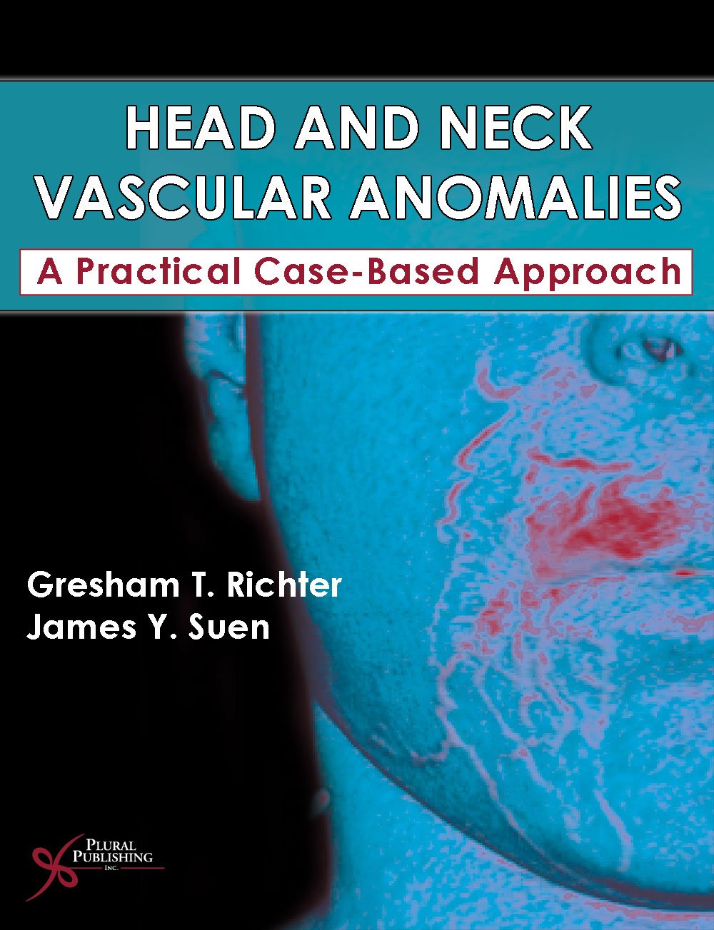 Head and Neck Vascular Anomalies: A Practical Case-Based Approach ...