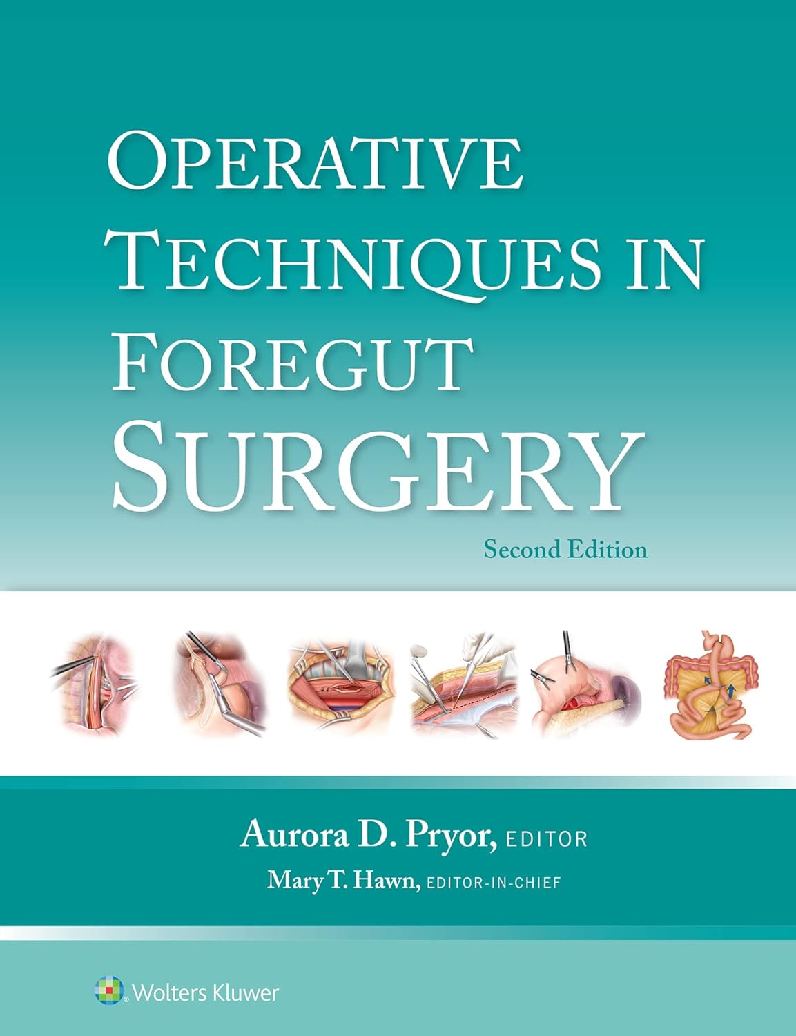 Amazon.com: Operative Techniques in Foregut Surgery eBook : Pryor ...