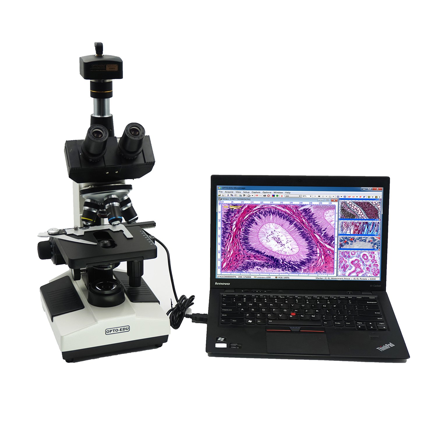 Buy OPTO-EDU A11.1008-5M Full Size Lab Digital Trinocular Compound LED ...