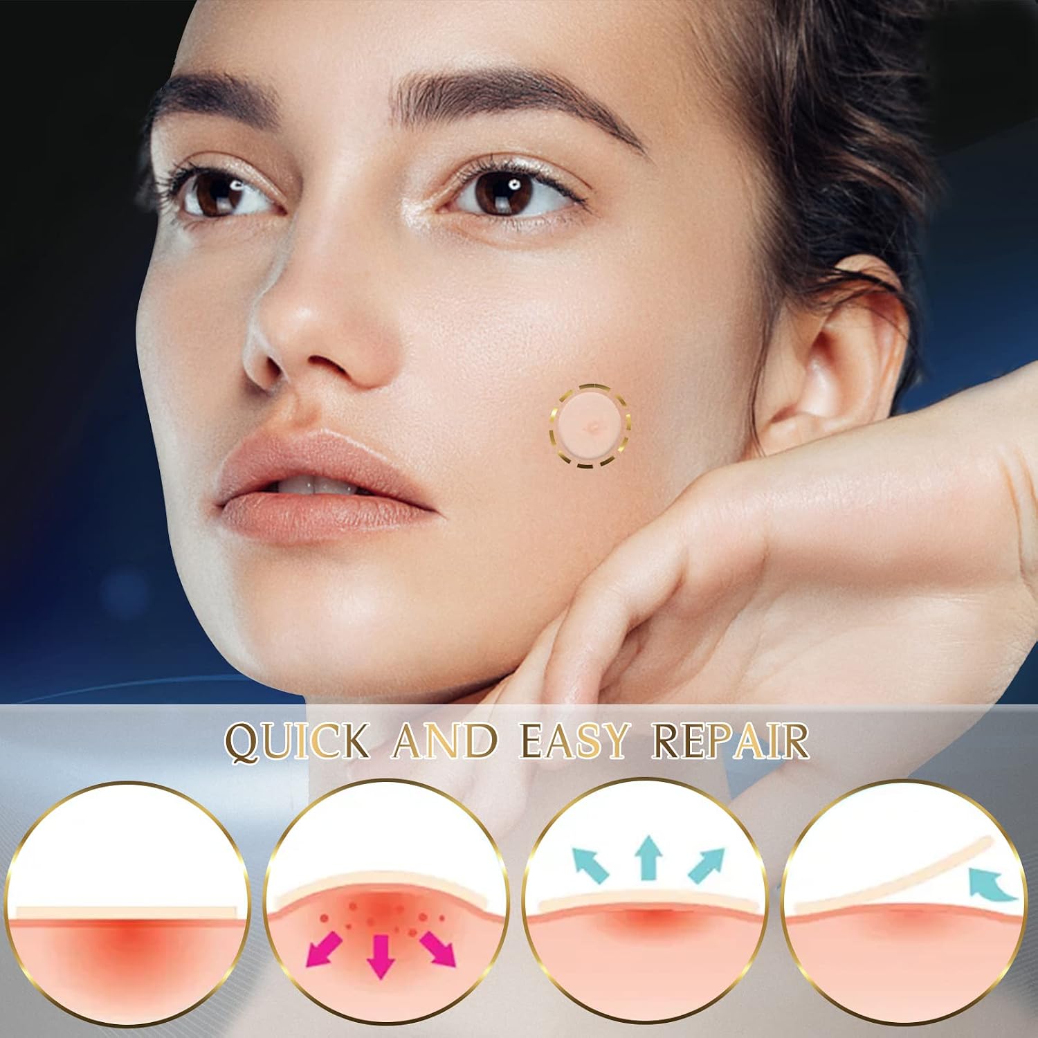 252pcs Pimple Patches Day & Night Use 2 in 1 Pimple Spots Invisible ...