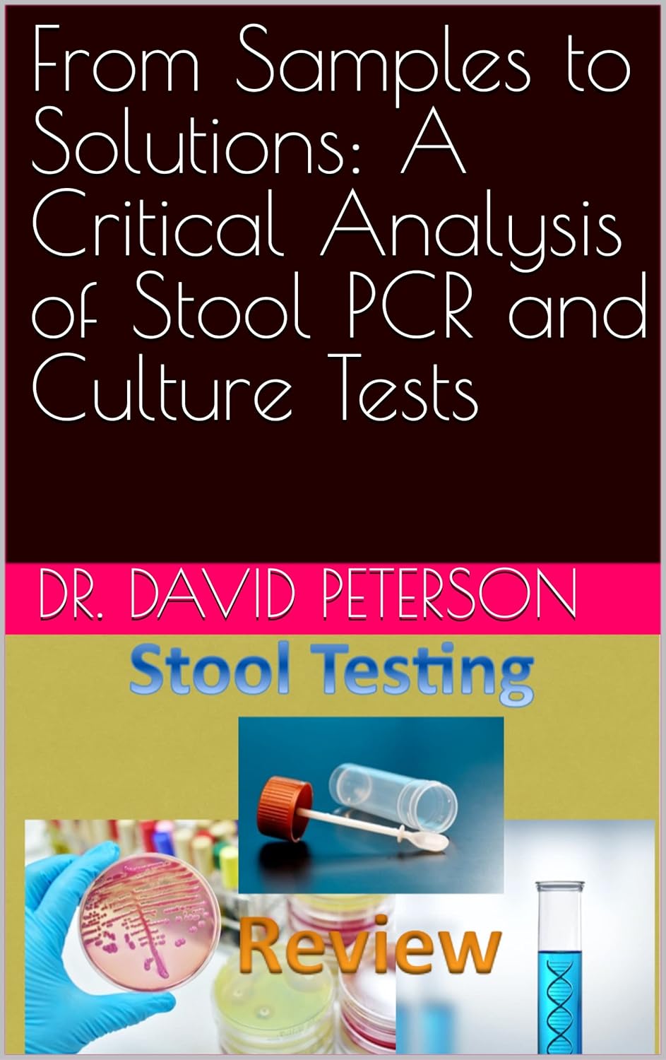 From Samples to Solutions: A Critical Analysis of Stool PCR and Culture ...