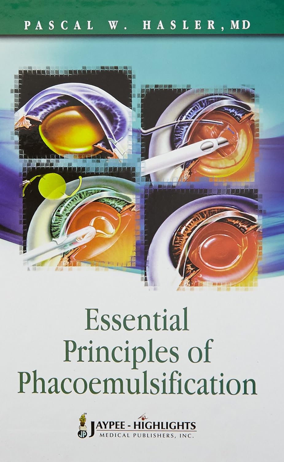 Essential Principles of Phacoemulsification: 9789962678618: Medicine ...