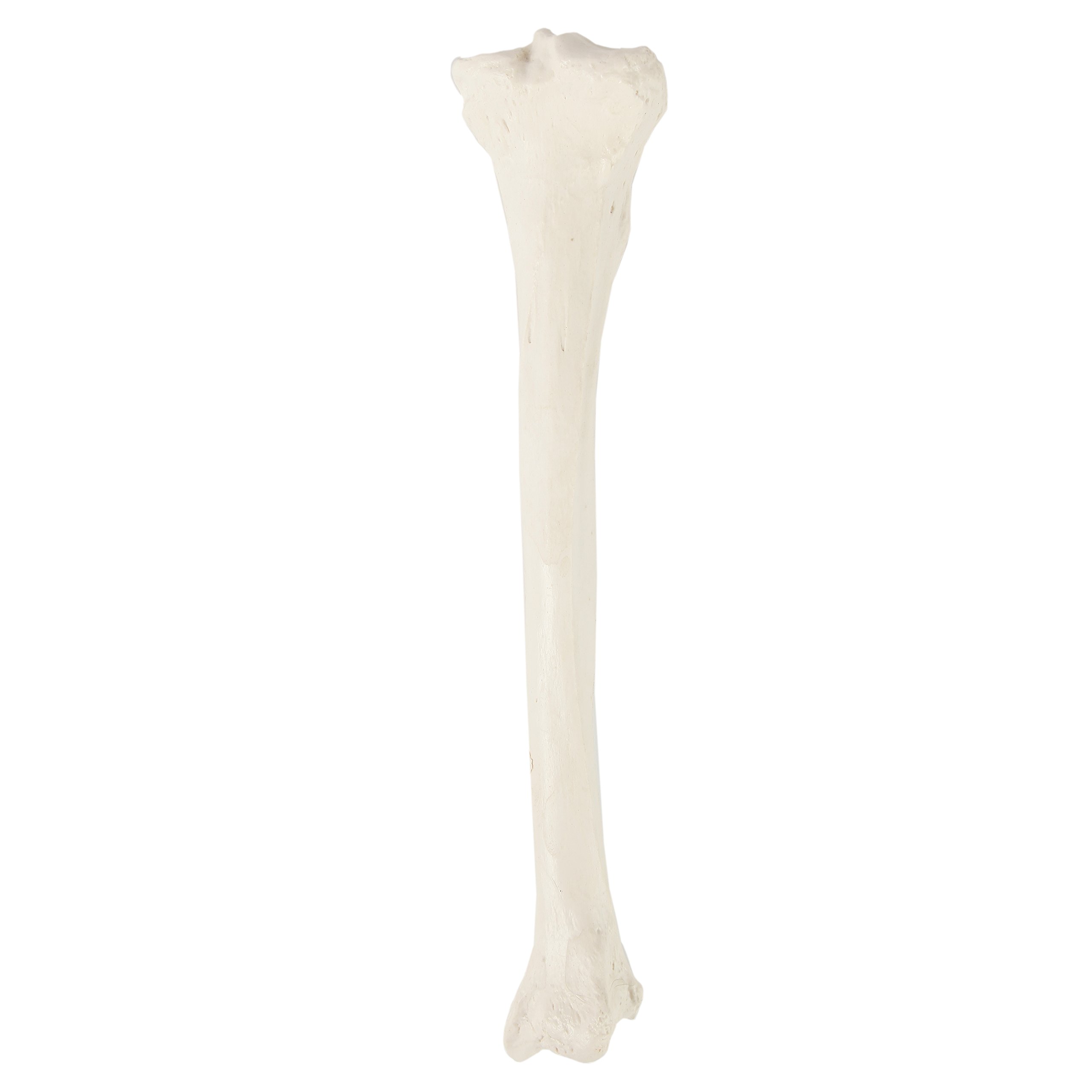 Human Tibia Fibula