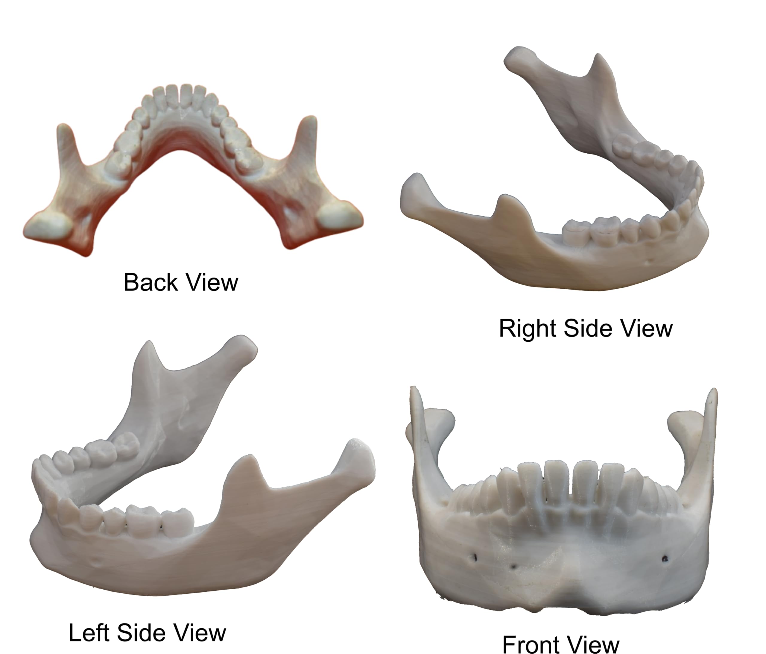 Upper Jaw Bone Anatomy Anatomy Structure