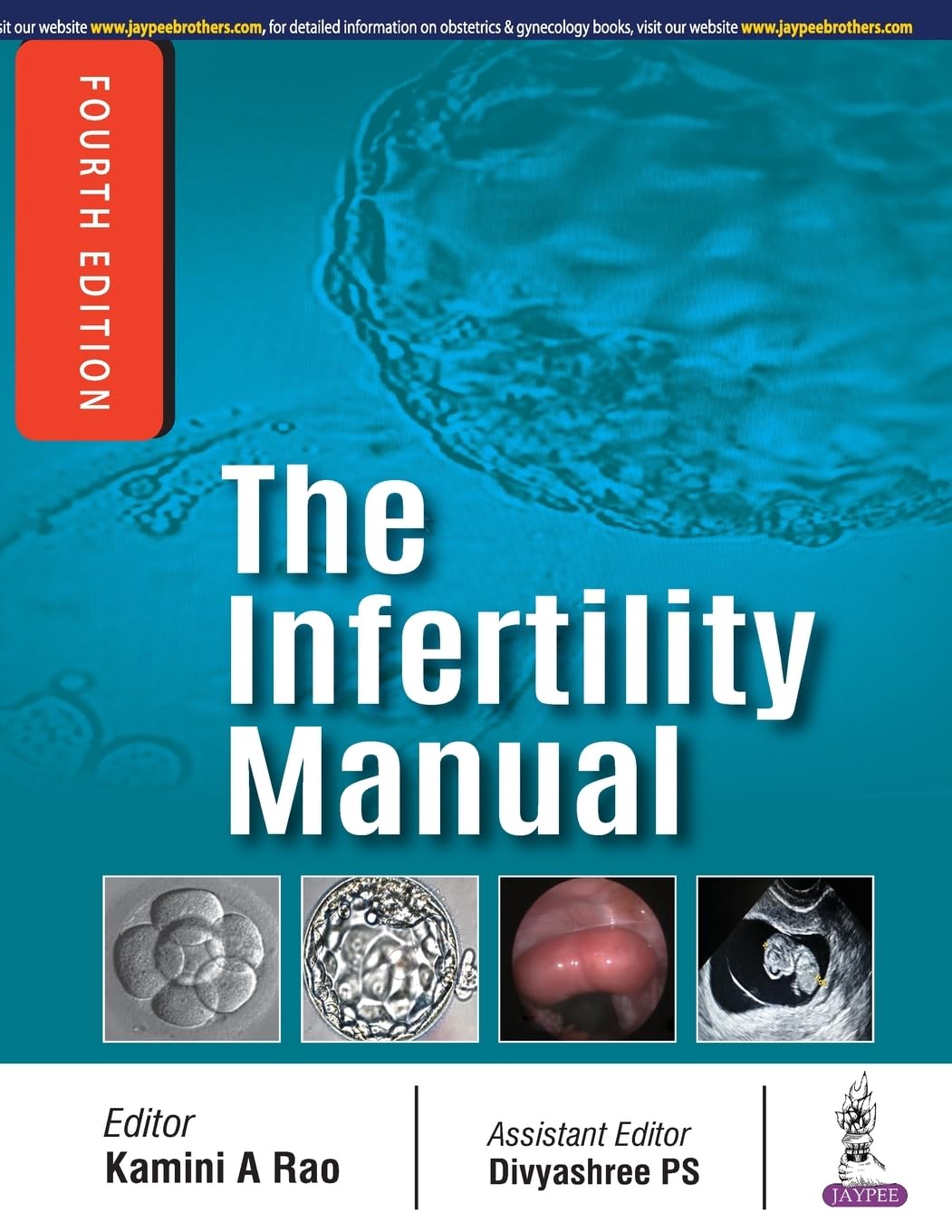 The Infertility Manual: 9789352701575: Medicine & Health Science Books ...