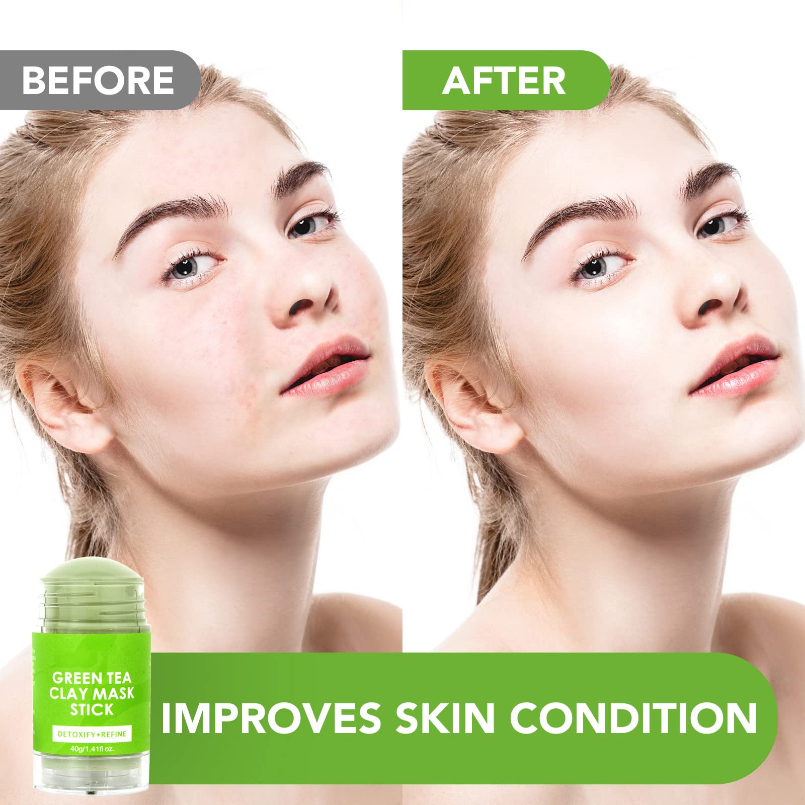 Green Skin Disorder