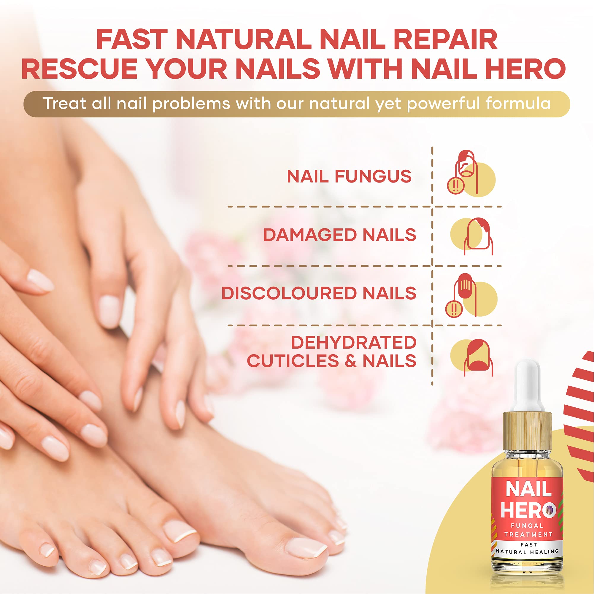 Buy Fungal Nail Treatment | Fast Natural Nail Treatment for Toenails ...