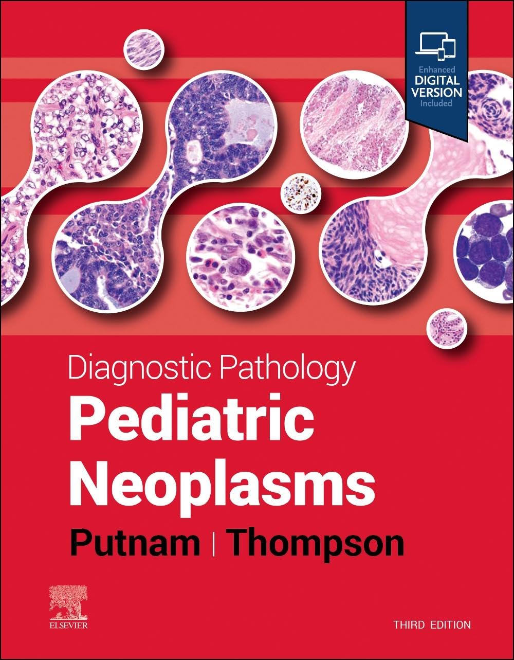 Diagnostic Pathology: Pediatric Neoplasms: 9780443224263: Medicine ...